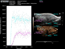 Ultrasound Contrast Agents | FUJIFILM VisualSonics