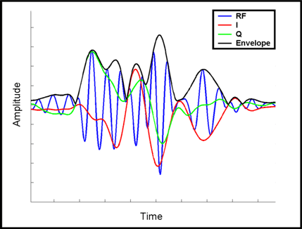 Digital RF-Mode | FUJIFILM VisualSonics