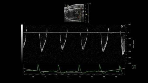 Pulsed-Wave Doppler | FUJIFILM VisualSonics