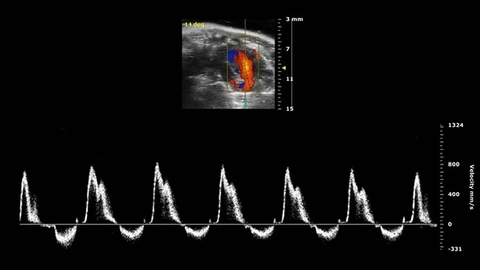 Pulsed-Wave Doppler | FUJIFILM VisualSonics