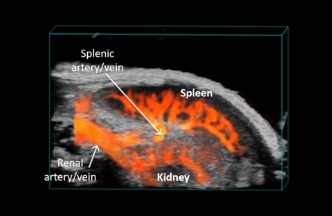 Renal and Splenic Vasculature | FUJIFILM VisualSonics