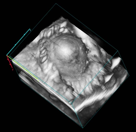 Mouse Eye 3D | FUJIFILM VisualSonics