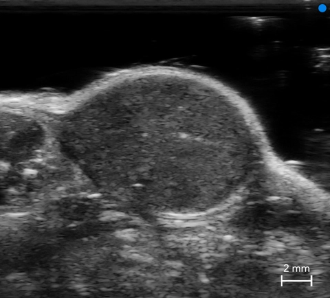 Subcutaneous Tumor | FUJIFILM VisualSonics