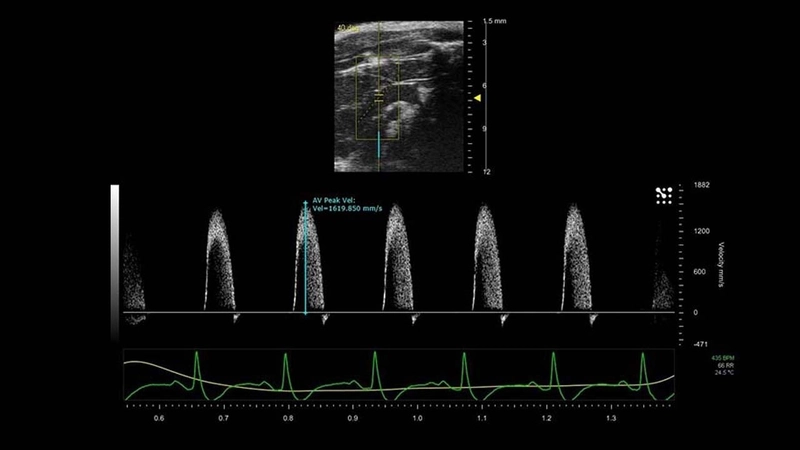 Pulsed-Wave Doppler | FUJIFILM VisualSonics