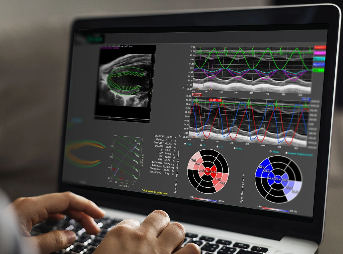 Vevo Strain 2.0 | FUJIFILM VisualSonics